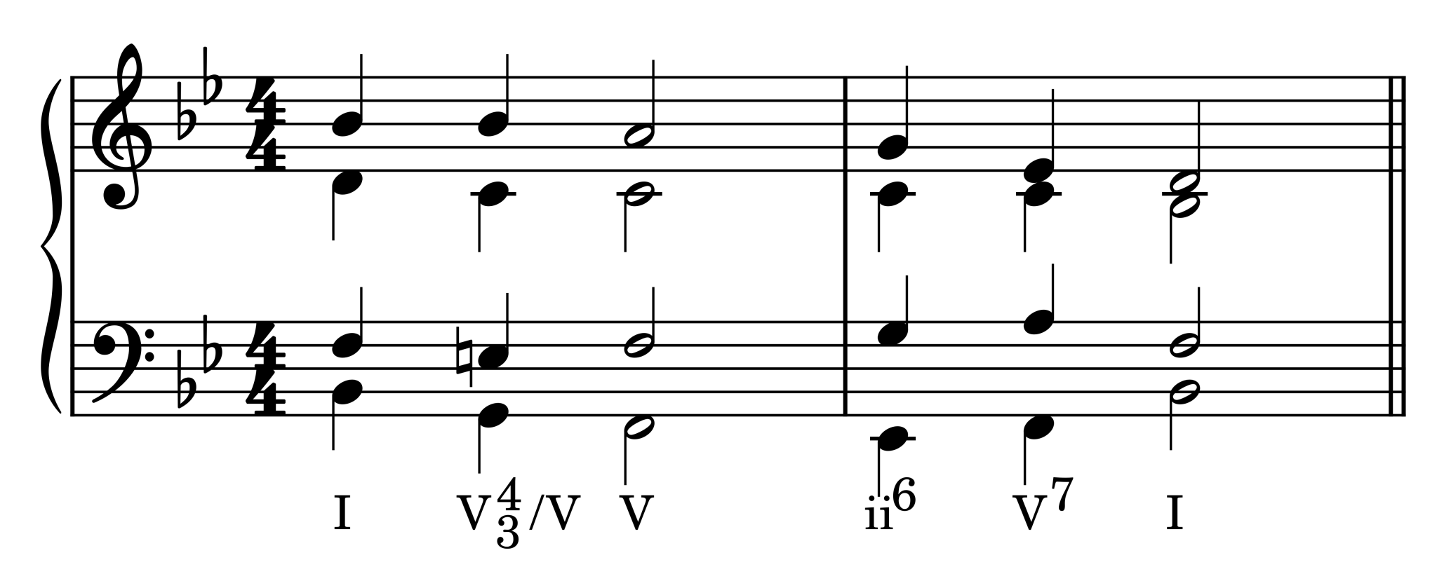 Harmonic Dictation Exam Review – Integrated Aural Skills
